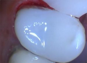 Bioclear - Home of Dentistry